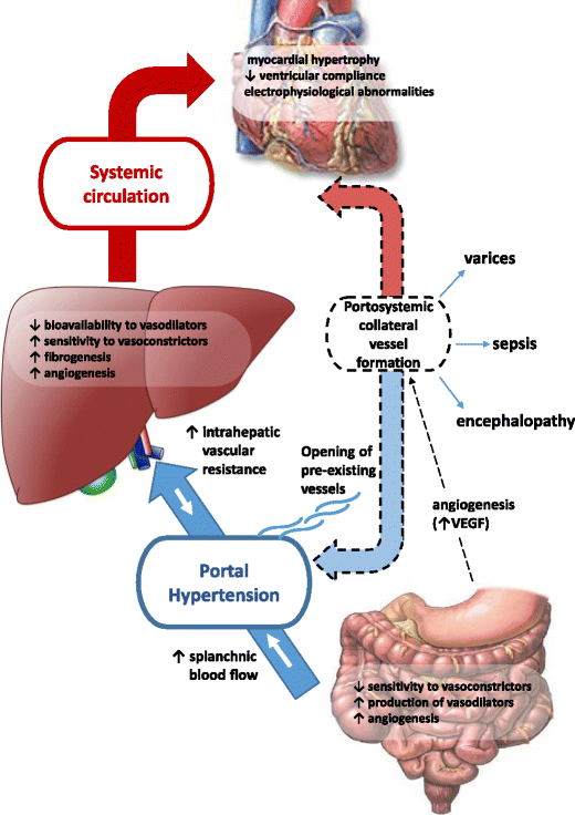 Patient Selection for Transjugular Intrahepatic Portosystemic Stent ...