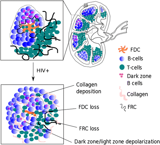 The Lymph Node In Hiv Pathogenesis Springerlink