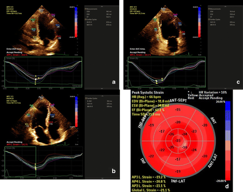 Echocardiography and Alternative Cardiac Imaging Strategies for Long ...
