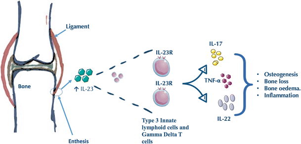 Enthesitis: Much More Than Focal Insertion Point Inflammation ...
