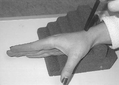 Classifications in Brief: The Eaton-Littler Classification of Thumb ...