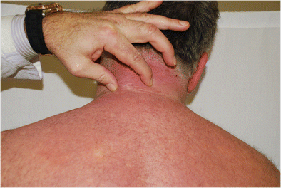 Cutaneous Manifestations of Scleroderma and Scleroderma-Like Disorders ...