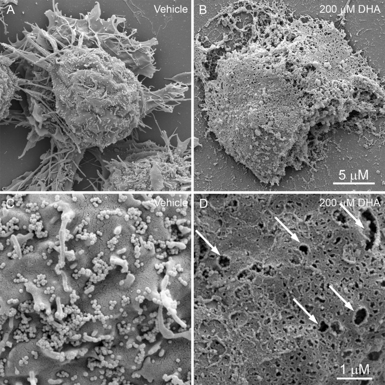 Ultrastructural Characteristics of DHA-Induced Pyroptosis | SpringerLink