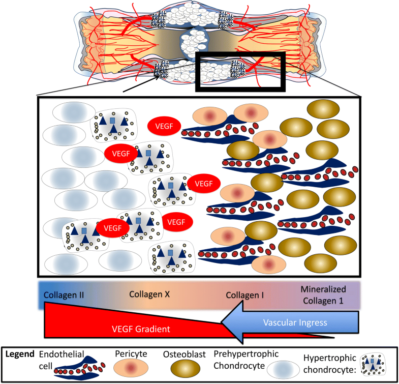 Bone Fracture Acute Phase Response—A Unifying Theory of Fracture Repair ...