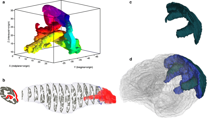 The Scalable Brain Atlas: Instant Web-Based Access to Public Brain ...