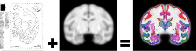 Rhesus Macaque Brain Atlas Regions Aligned to an MRI Template ...