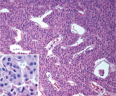 Oncocytes, Oxyphils, Hürthle, and Askanazy Cells: Morphological and ...