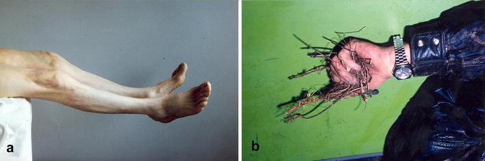 Methods for determining time of death | SpringerLink