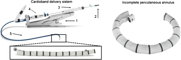 Cardioband system: a novel percutaneous solution for atrioventricular ...