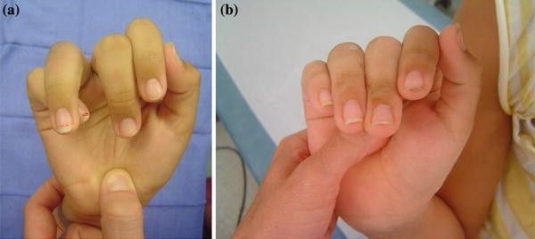 Non-operative treatment of common finger injuries | SpringerLink