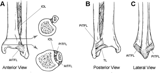 Syndesmosis injuries | SpringerLink