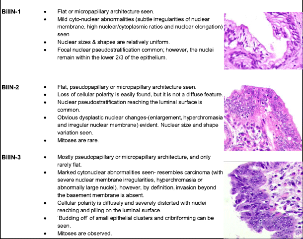 Pathology of Gallbladder Carcinoma: Current Understanding and New ...