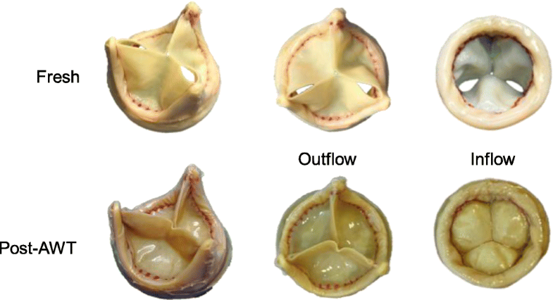 A Durable Porcine Pericardial Surgical Bioprosthetic Heart Valve: a ...