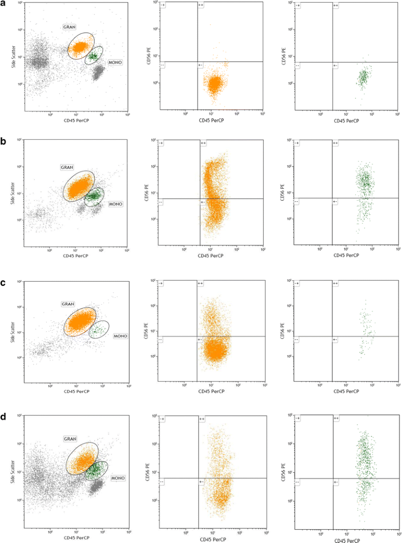 Aberrant expression of CD56 on granulocytes and monocytes in ...