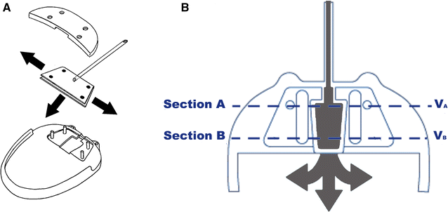 A Review of the Ahmed Glaucoma Valve Implant and Comparison with Other ...