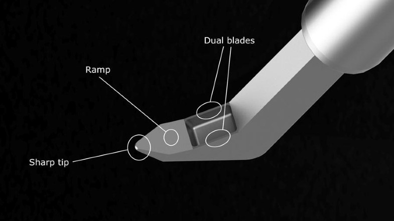12-Month Outcomes of Goniotomy Performed Using the Kahook Dual Blade ...