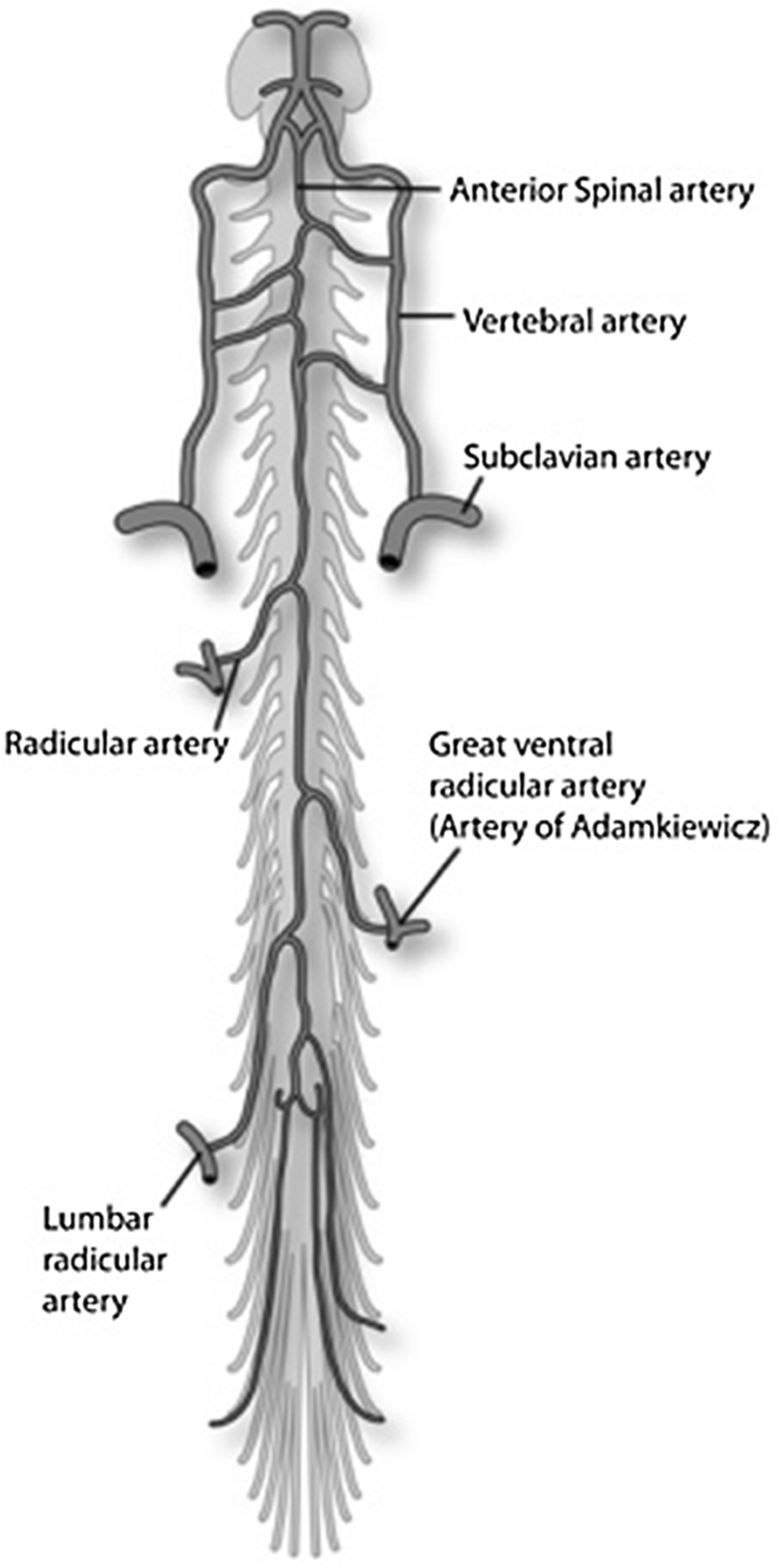 Epidural Corticosteroids, Lumbar Spinal Drainage, and Selective ...