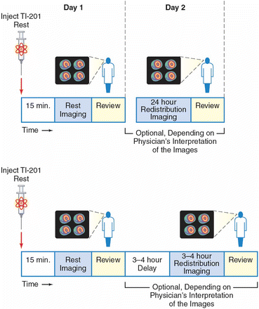 ASNC imaging guidelines for SPECT nuclear cardiology procedures: Stress ...