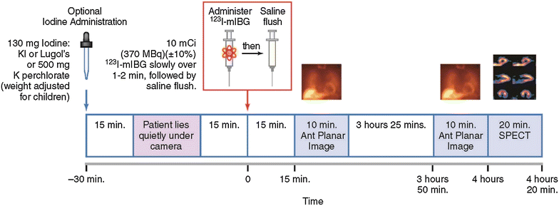 ASNC imaging guidelines for SPECT nuclear cardiology procedures: Stress ...