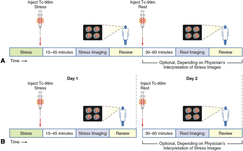 ASNC imaging guidelines for SPECT nuclear cardiology procedures: Stress ...