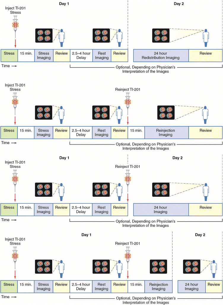 ASNC imaging guidelines for SPECT nuclear cardiology procedures: Stress ...
