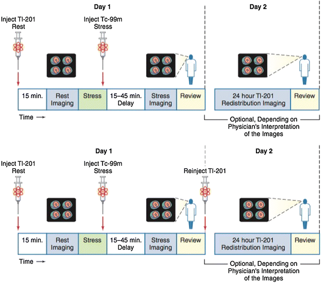 ASNC imaging guidelines for SPECT nuclear cardiology procedures: Stress ...