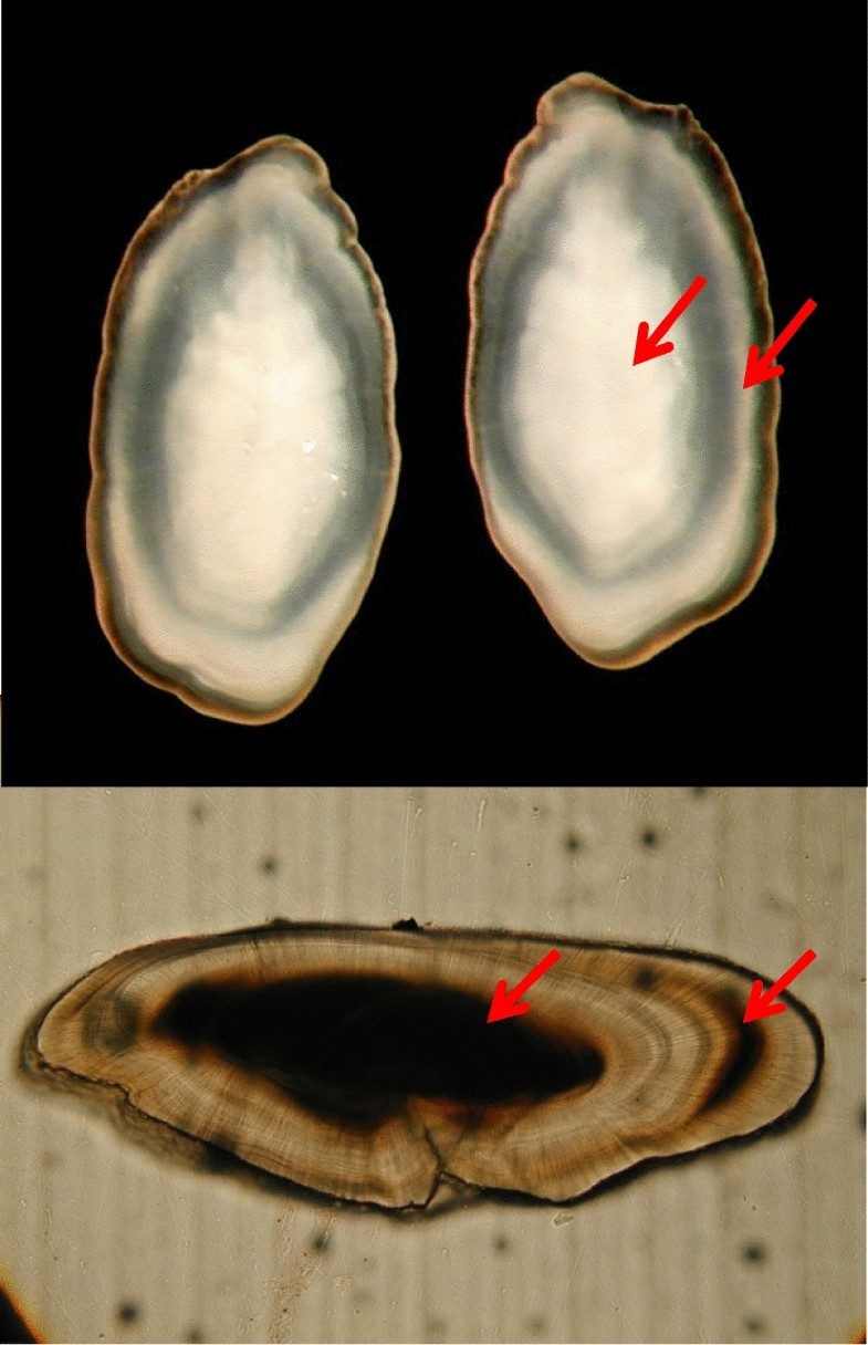 A description of four types of otolith opaque zone | SpringerLink