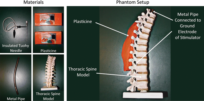Paramedian thoracic epidural training model | SpringerLink