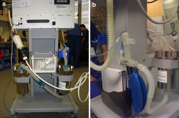 The scavenging of volatile anesthetic agents in the cardiovascular ...
