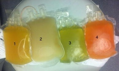 The colour of plasma | SpringerLink