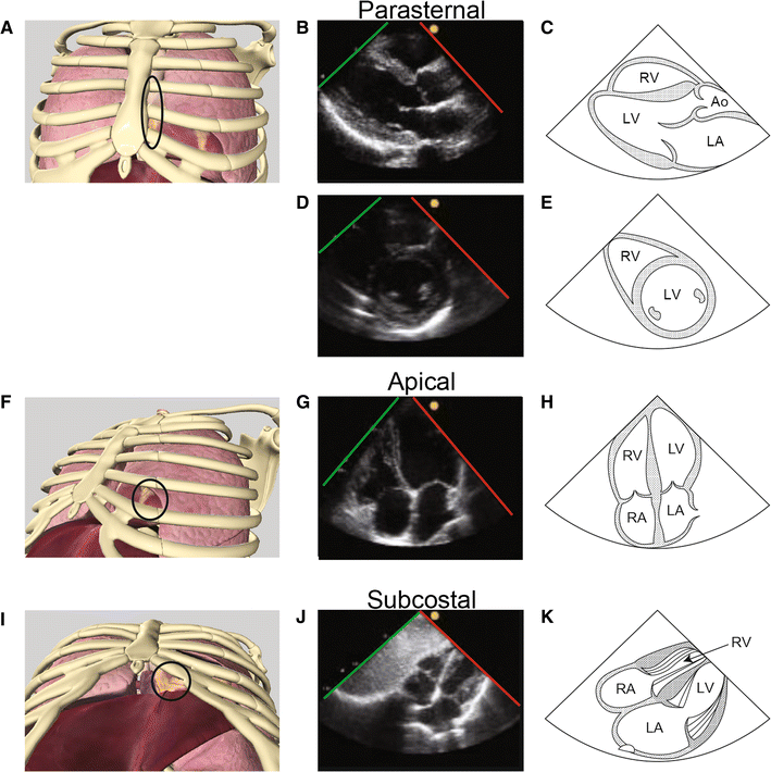 Transthoracic echocardiographic evaluation of the heart and great ...