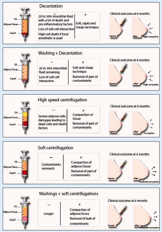 Soft preparation of fat for lipotransfer | SpringerLink