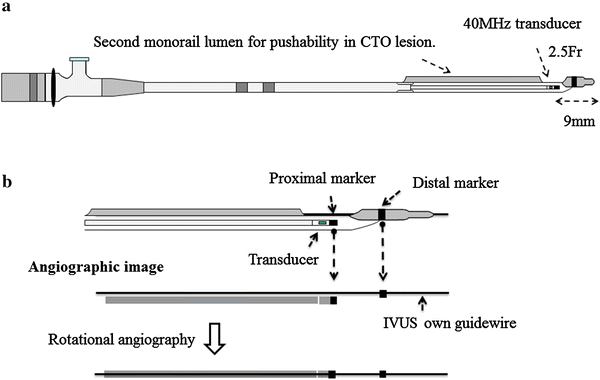 Navifocus WR is the promising intravascular ultrasound for navigating ...