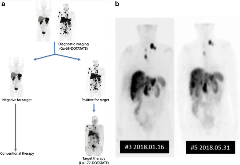 Nuclear Theranostics in Asia: In vivo Companion Diagnostics | SpringerLink