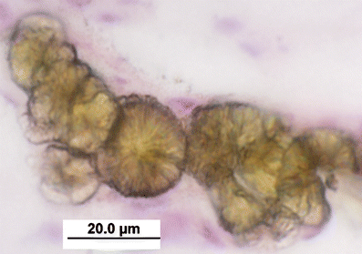 Melamine Toxicity—Stones vs. Crystals | SpringerLink