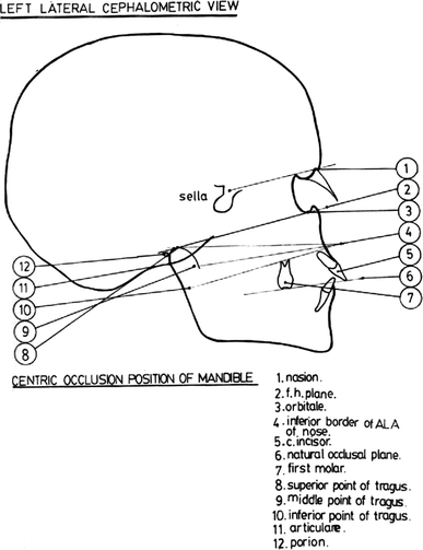 Age Changes in Horizontal Condylar Angle: A Clinical and Cephalometric ...