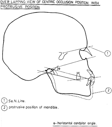 Age Changes in Horizontal Condylar Angle: A Clinical and Cephalometric ...