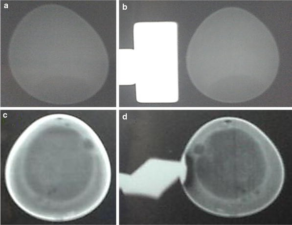 Synthesis and characterization of superparamagnetic iron-oxide ...