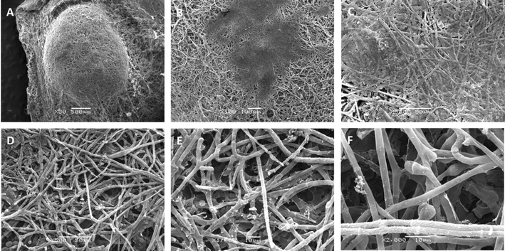 Morphological development of sclerotia by Sclerotinia sclerotiorum: a ...