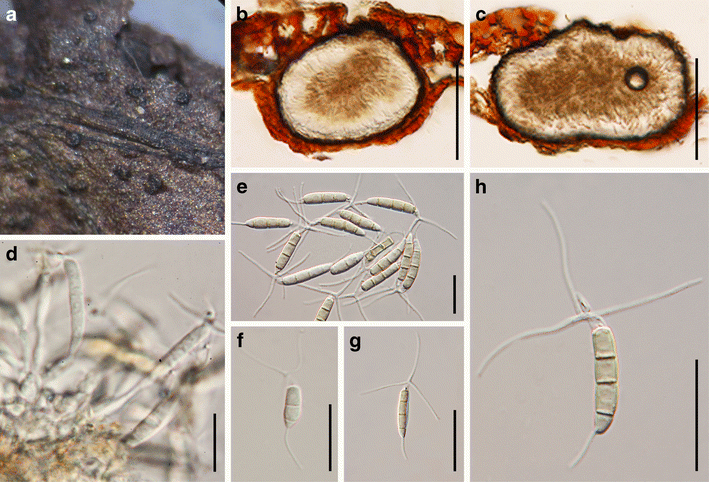 Families of Sordariomycetes | SpringerLink