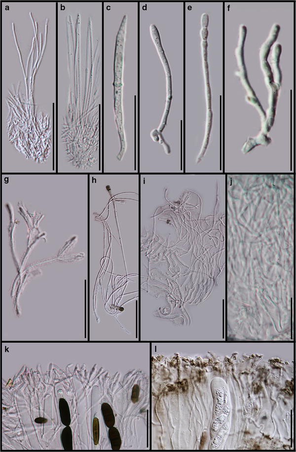 DISCOMYCETES: the apothecial representatives of the phylum Ascomycota ...