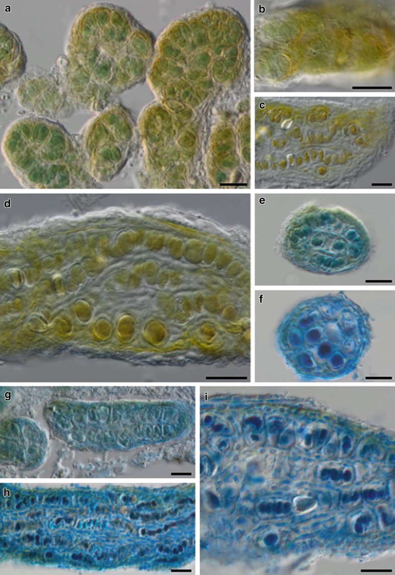 Lichinodium is a new lichenized lineage in the Leotiomycetes | SpringerLink