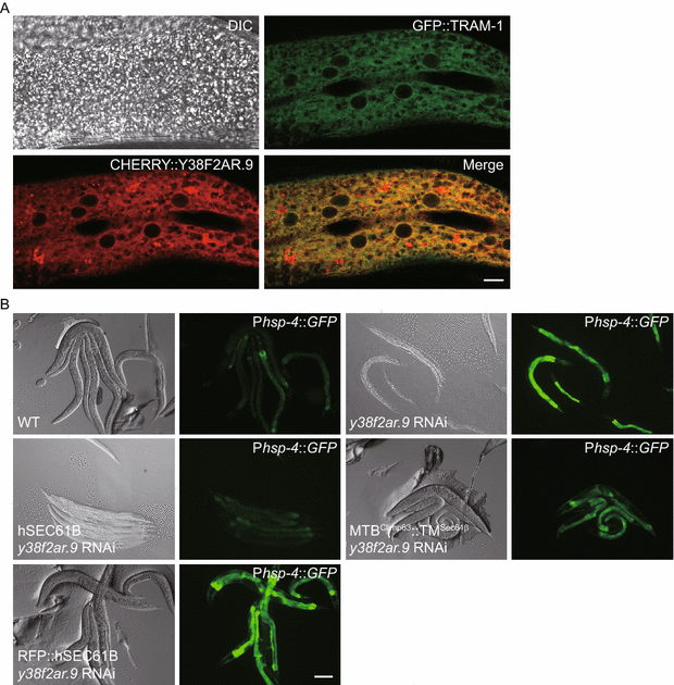 Sec61β facilitates the maintenance of endoplasmic reticulum homeostasis ...