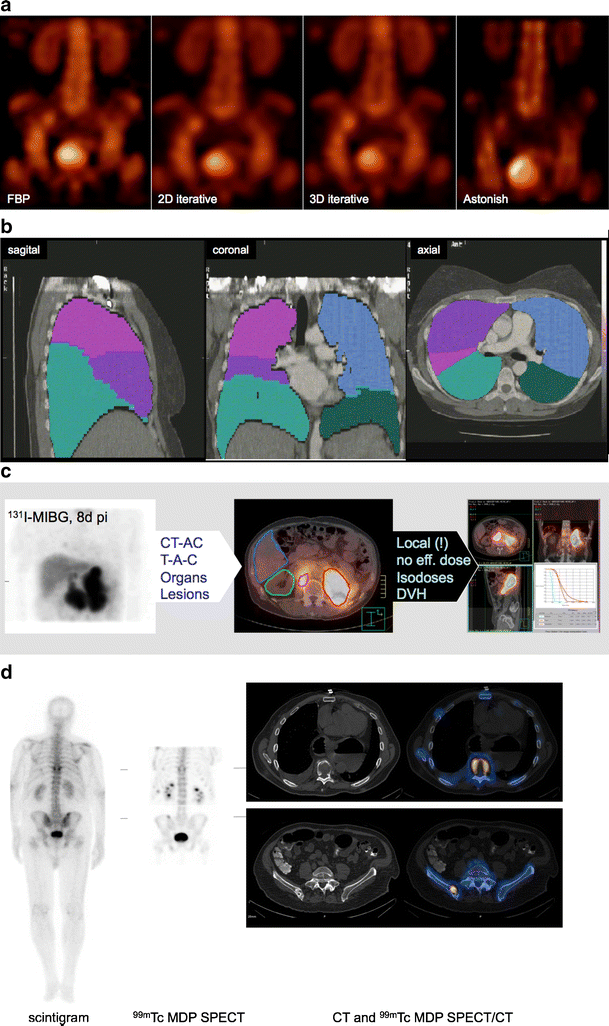 The future of hybrid imaging—part 1: hybrid imaging technologies and SPECT/CT | Insights into ...