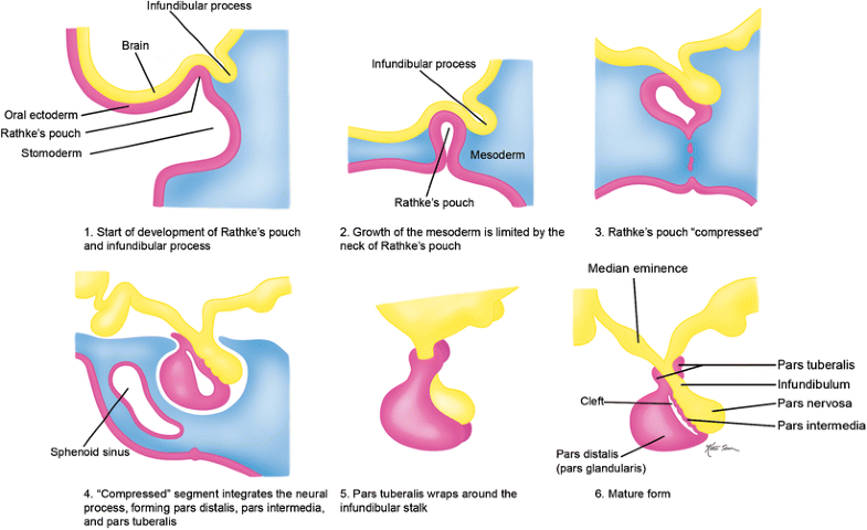 Magnetic resonance imaging of sellar and juxtasellar abnormalities in ...