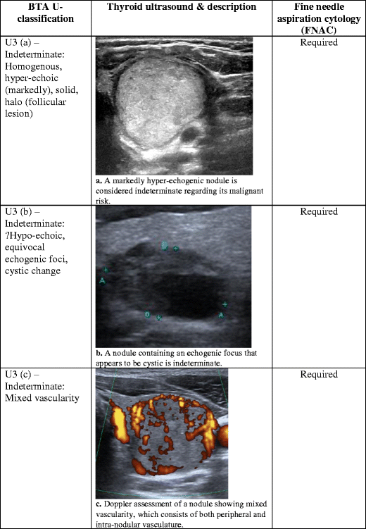 Ultrasonography of thyroid nodules: a pictorial review | SpringerLink