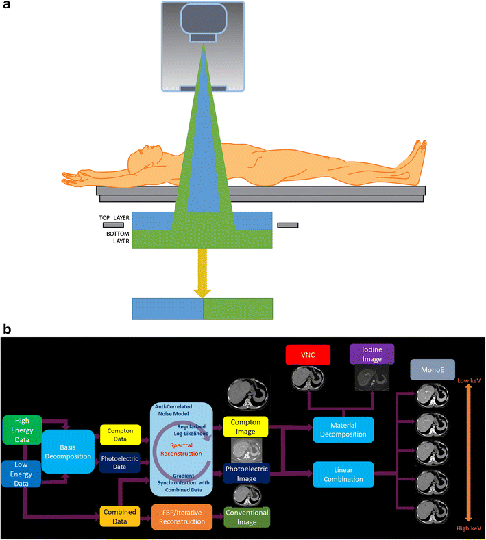Detector-based spectral CT with a novel dual-layer technology: principles and applications ...