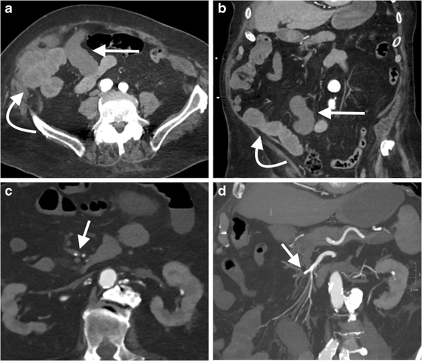 Vascular CT and MRI: a practical guide to imaging protocols | SpringerLink