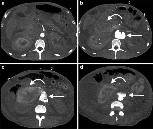 Vascular CT and MRI: a practical guide to imaging protocols | SpringerLink