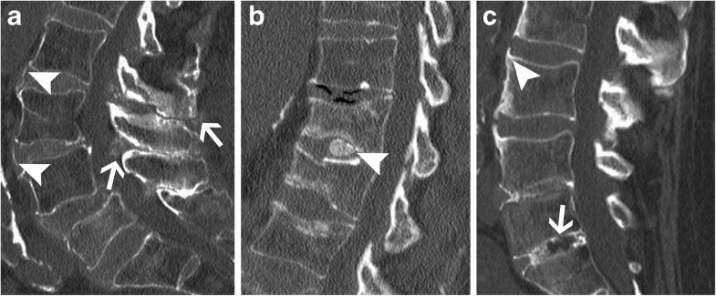 Radiological identification and analysis of soft tissue musculoskeletal ...